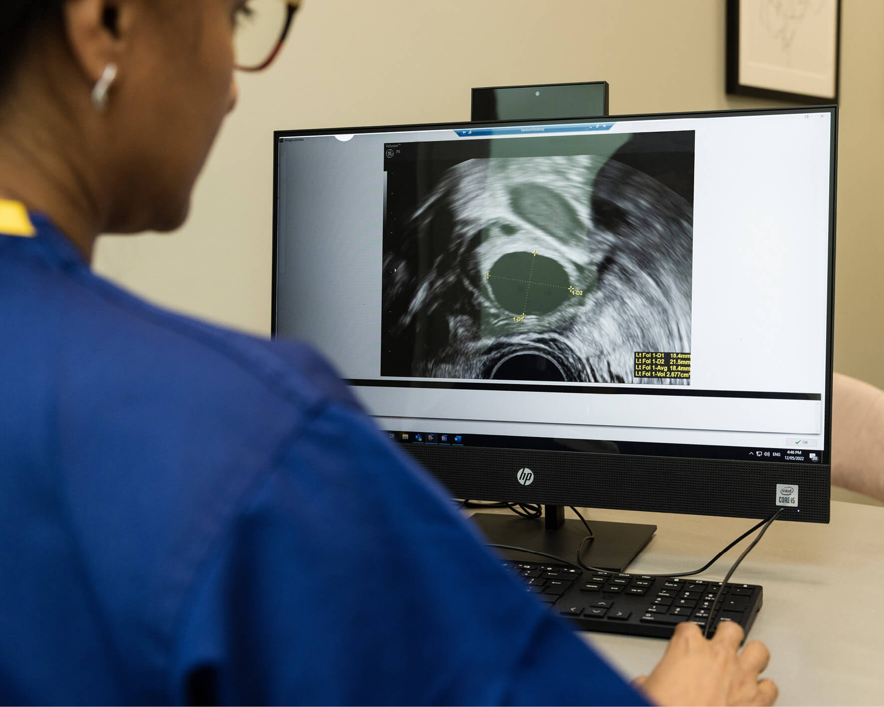 What is Ovulation Induction? | IVF Clinic London I The Evewell